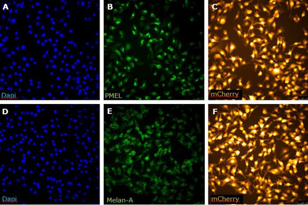 RMS RET Melanoma-sorted Mouse Cell Line | SCC462